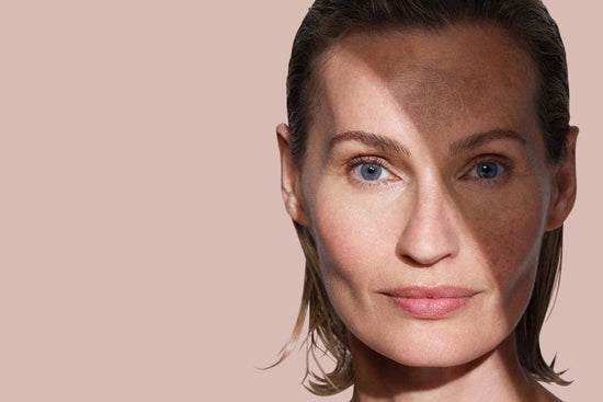 MARE PERFECT SKIN – MARE Skin Perfect